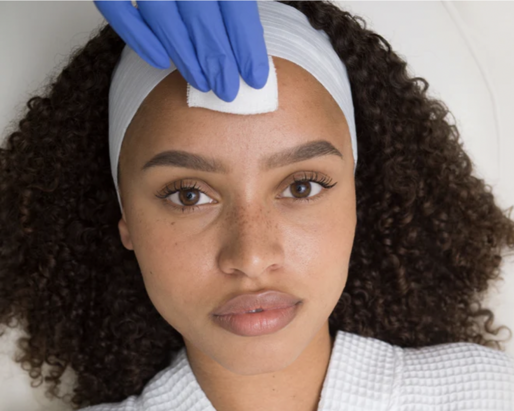 The VI Peel Process Day by Day: What to Expect & How to Care for Your ...